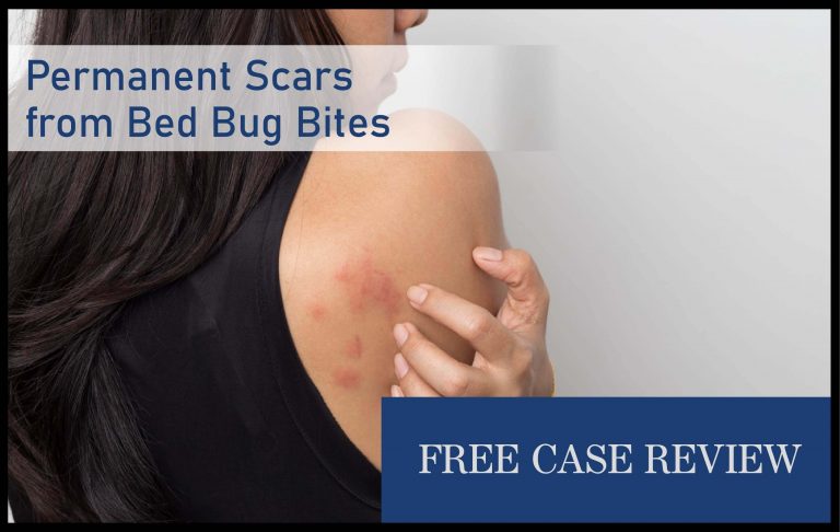 Permanent Scars from Bed Bug Bites Attorney - Bed Bug Lawyer Los ...
